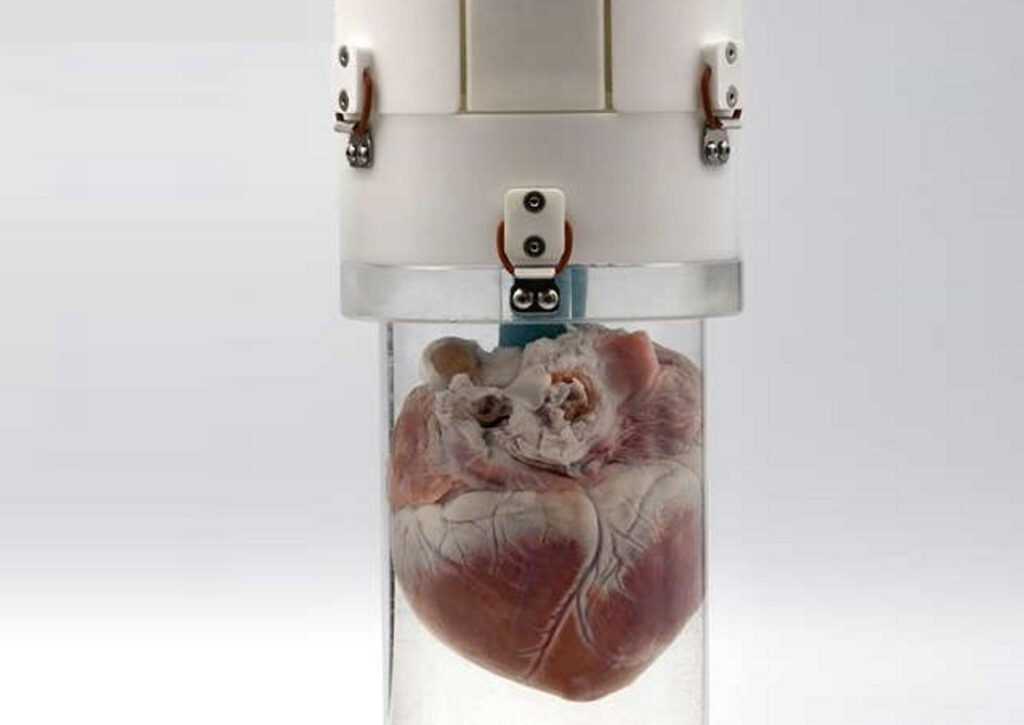 New Device May Extend the Viability of Hearts Before Heart ...