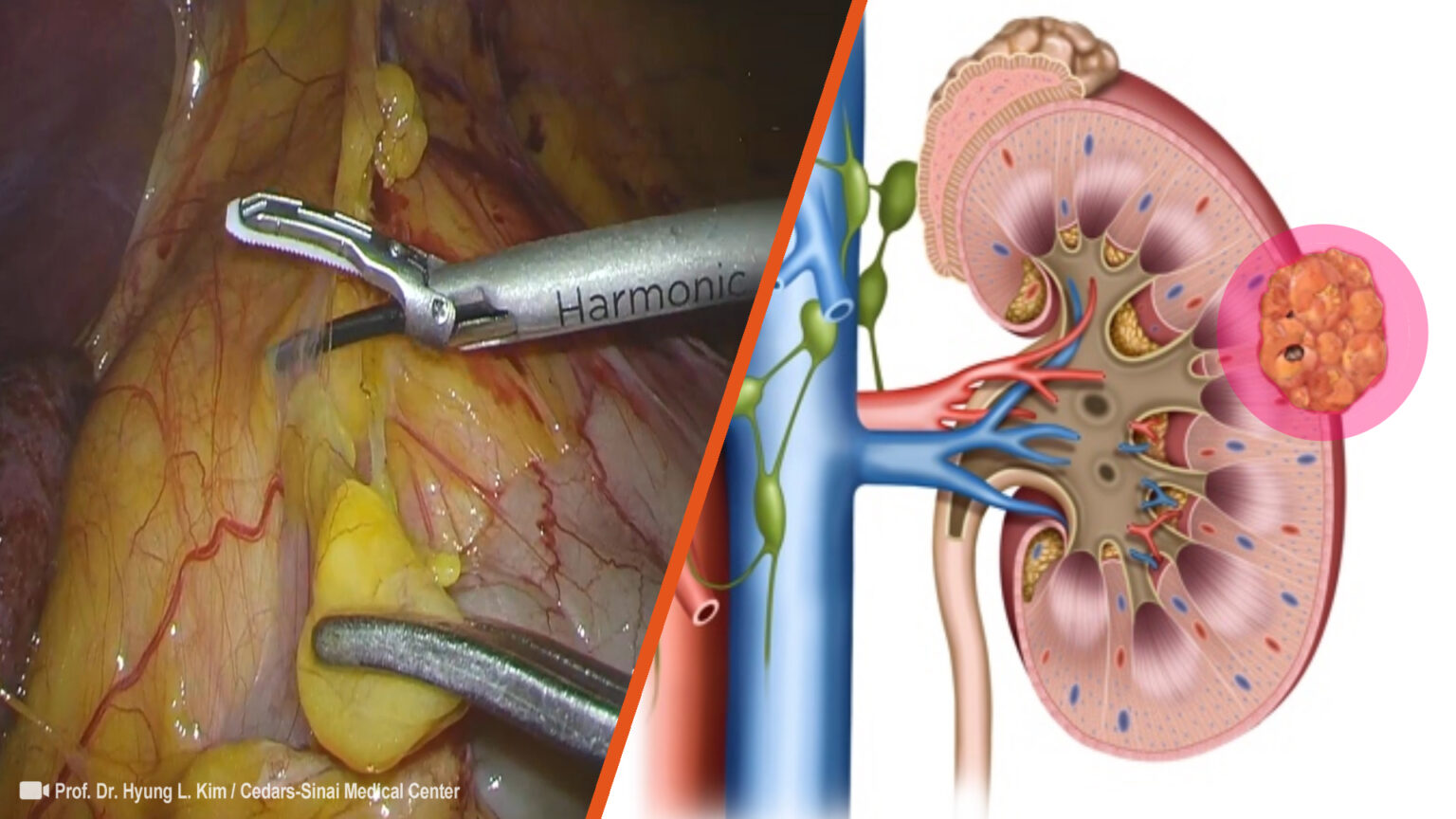 Surgeries A-Z | SurgMedia
