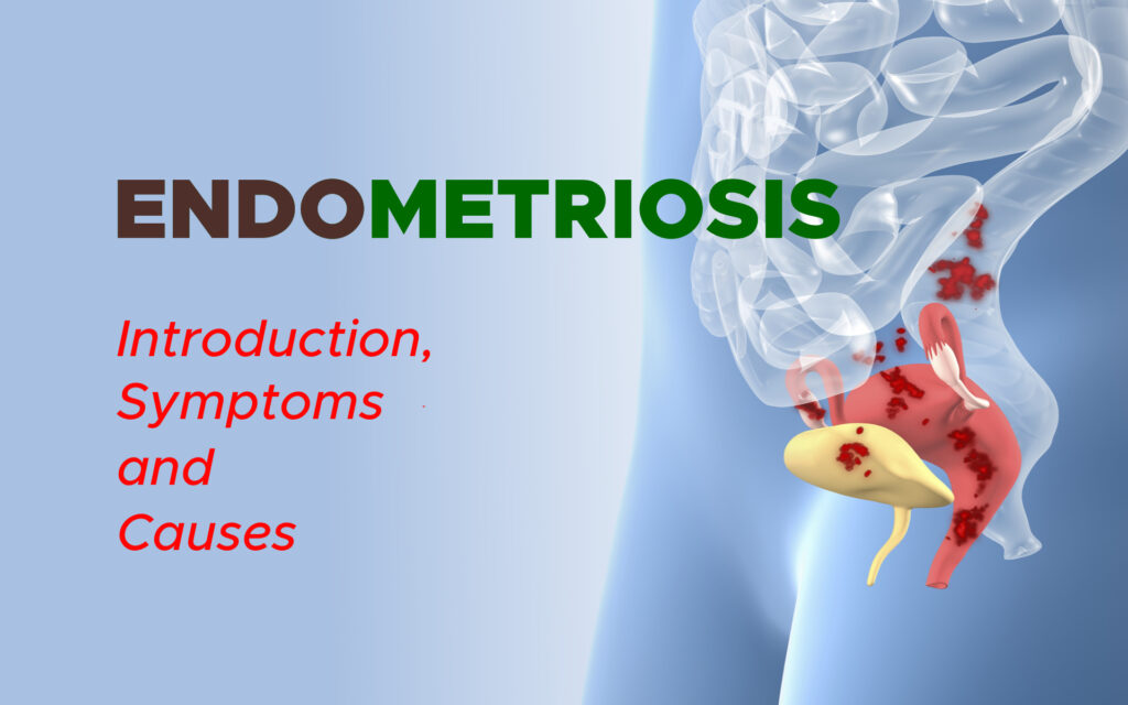 Endometrioza Simptome