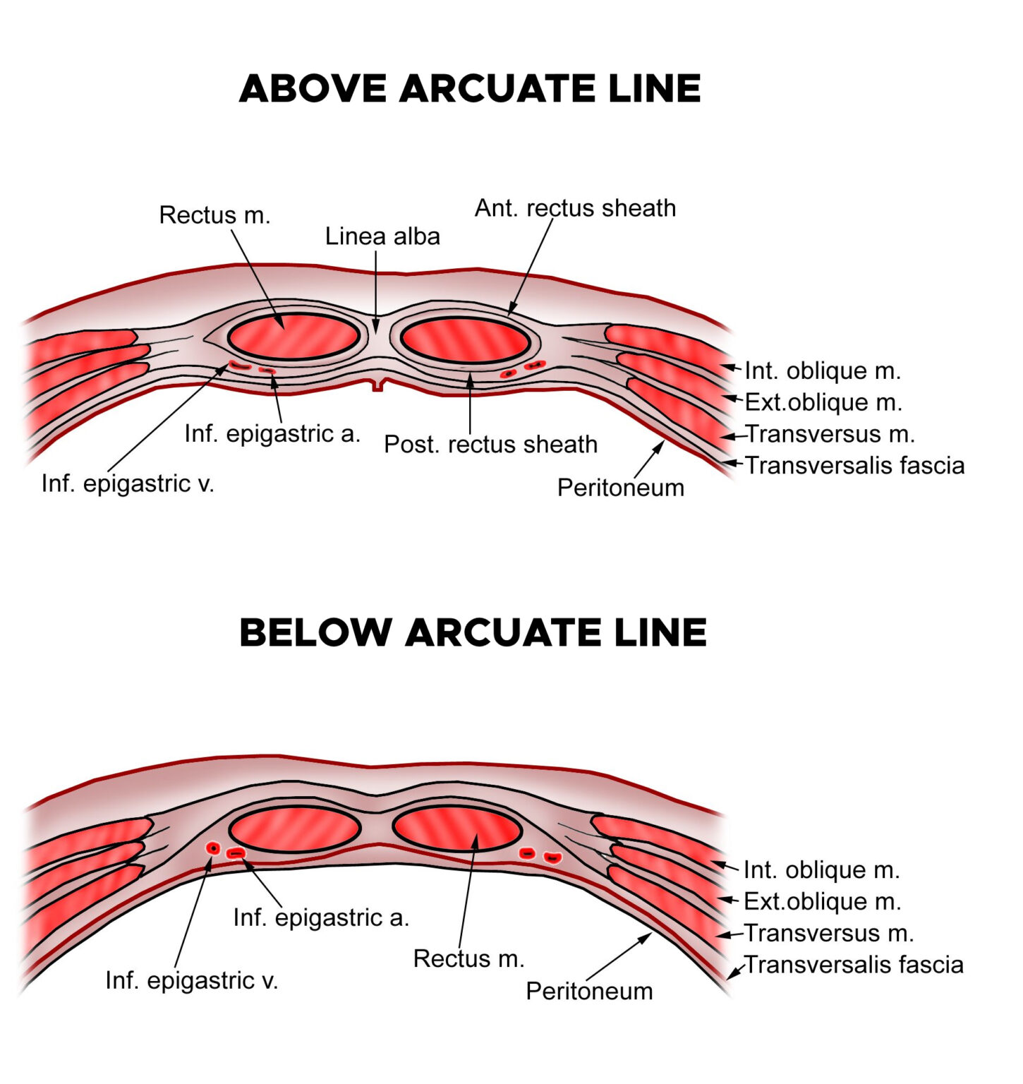 Abdominal Incisions and Anatomy of the Abdominal Wall | SurgMedia