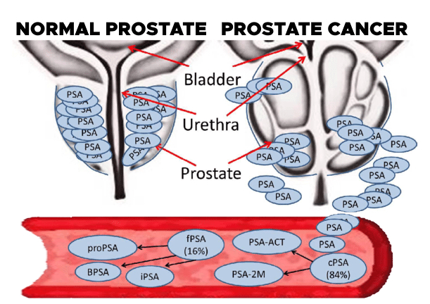 Prostate Cancer: Introduction, Risk Factors, Prevention, Screening, Symptoms and Signs | SurgMedia