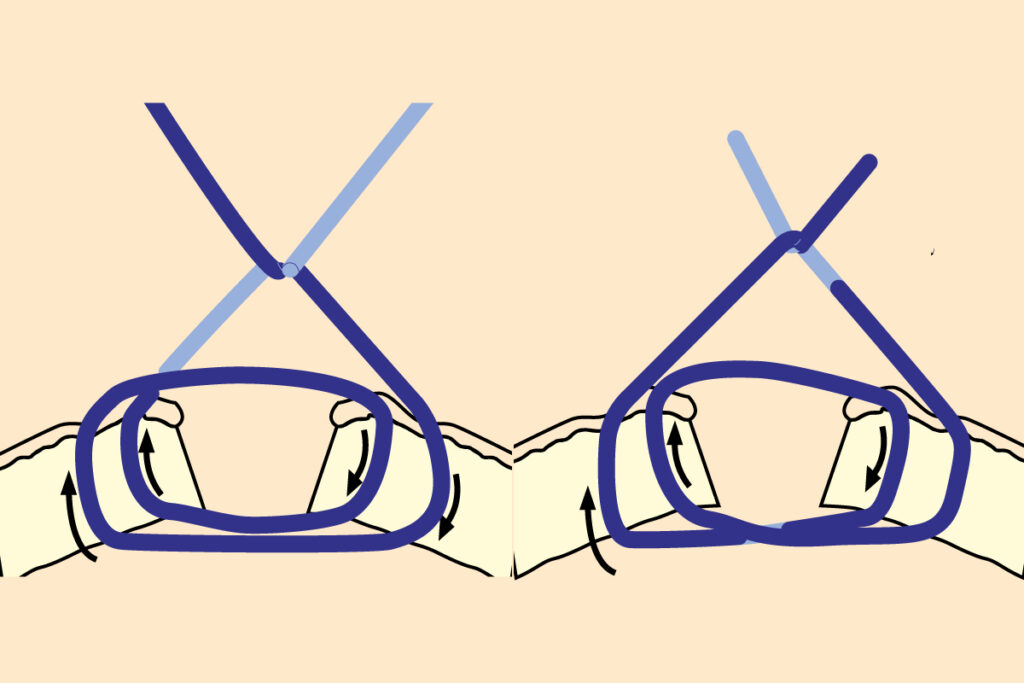Common Suture Patterns | SurgMedia