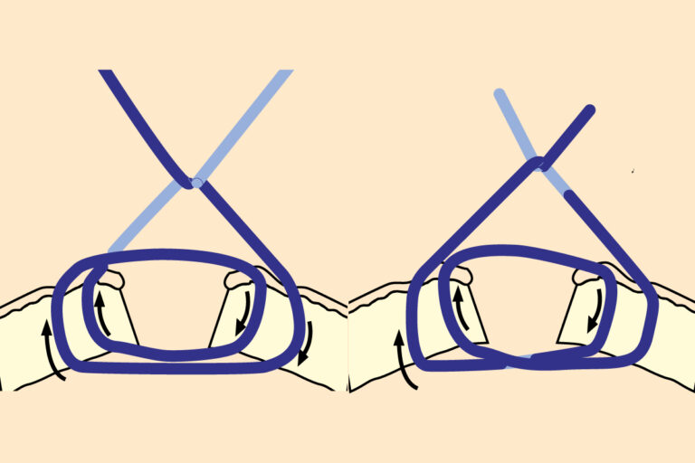 Common Suture Patterns | SurgMedia