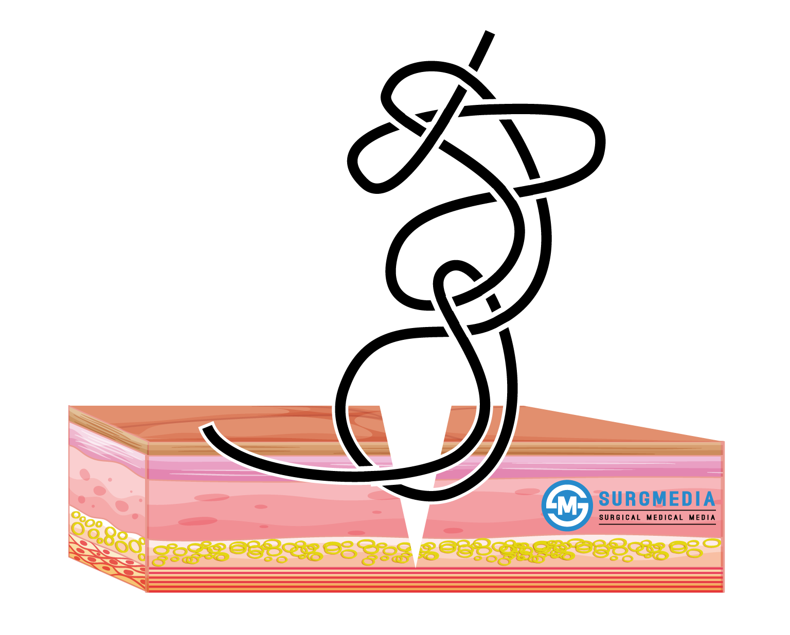 Common Surgical Knot Types | SurgMedia