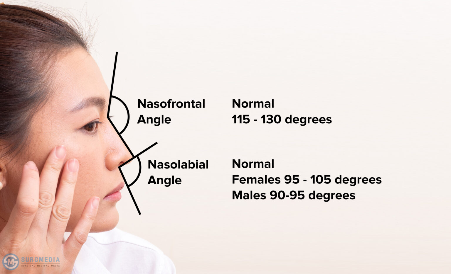 What is Rhinoplasty? | SurgMedia