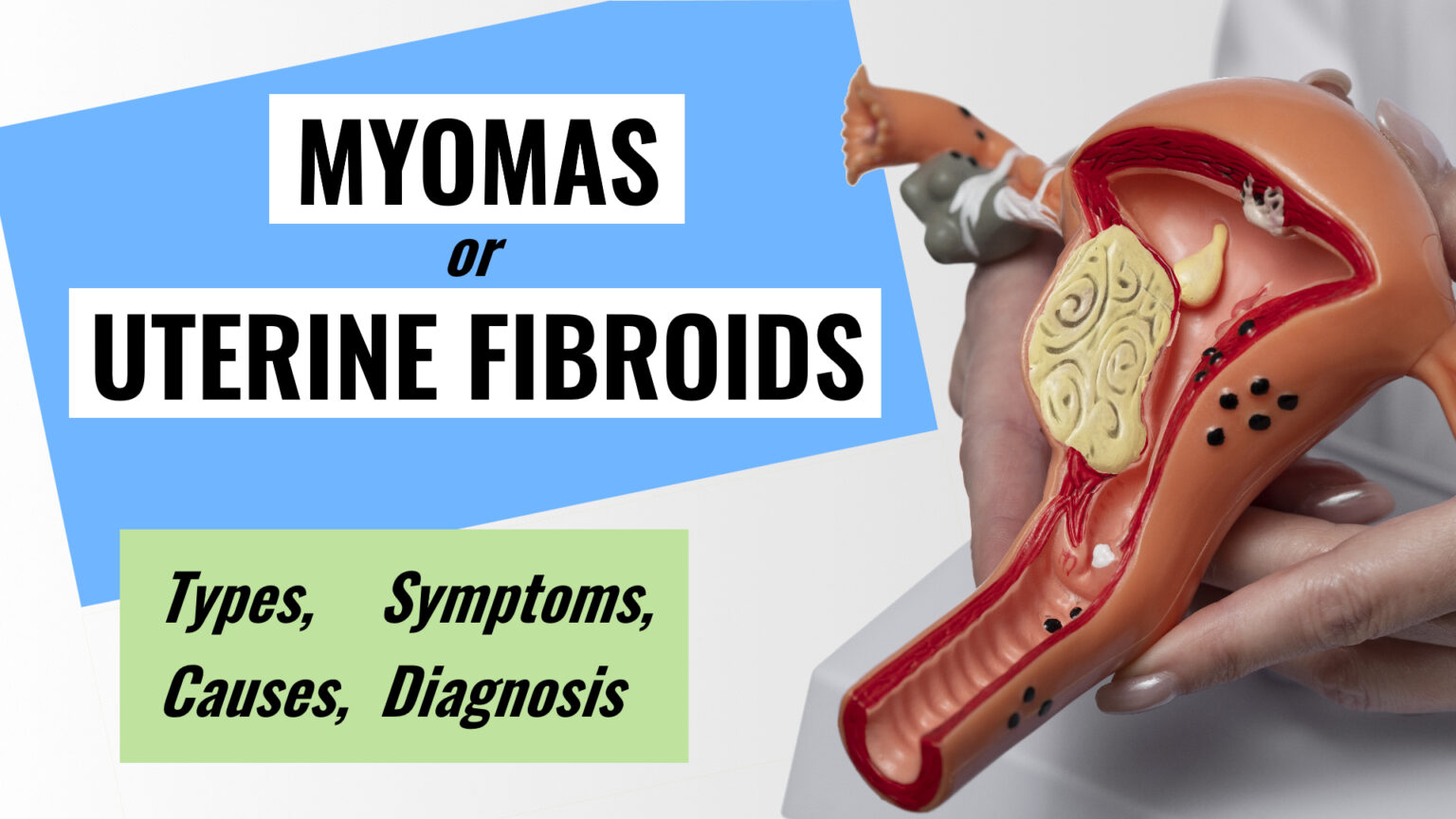 Uterine Fibroids (Myomas): Types, Causes, Symptoms, Diagnosis | SurgMedia