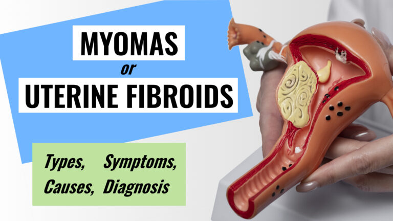 Uterine Fibroids (Myomas): Types, Causes, Symptoms, Diagnosis | SurgMedia